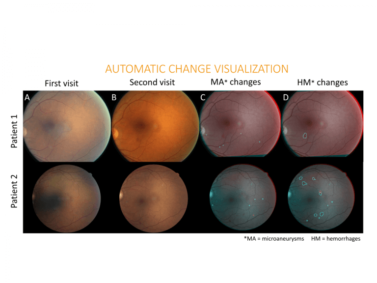 Products Under Development - Eyenuk, Inc. ~ Artificial Intelligence Eye ...